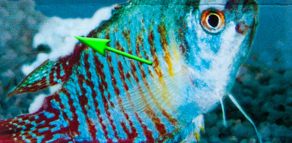 Erkrankungen durch Ciliaten (Wimpertierchen) z.B ...